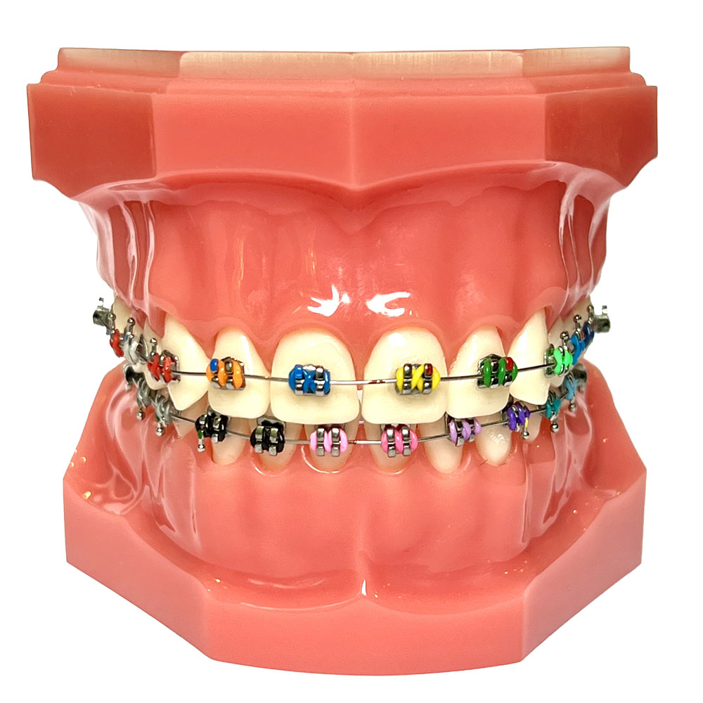 Braces In Castro Valley - Kids, Teens, & Adults